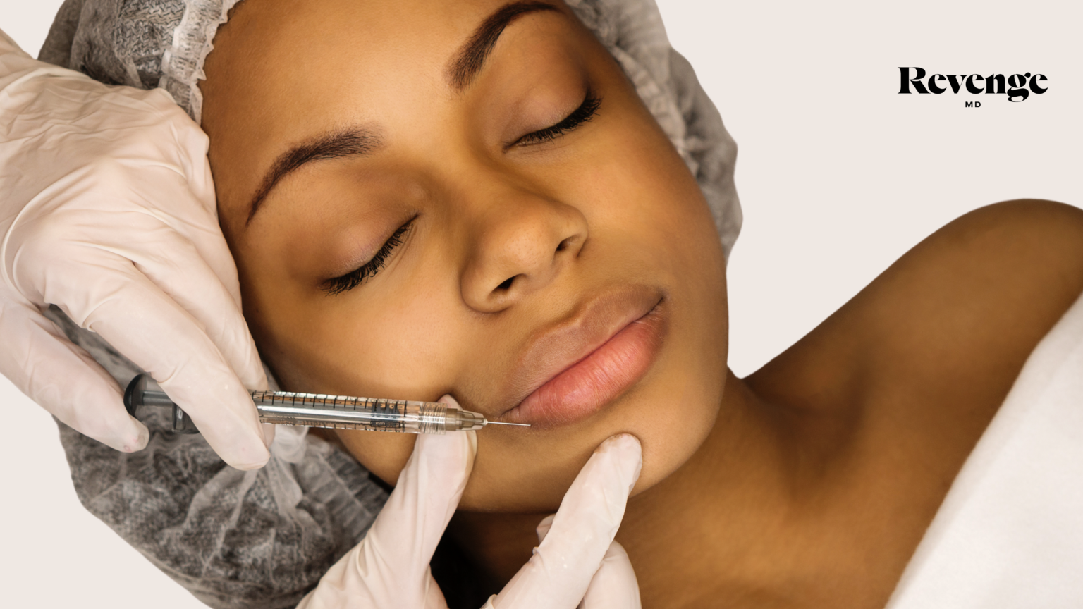 Lip Filler Before & After: Enhance Your Pout with Confidence