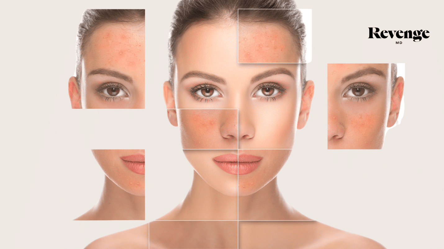 Exosomes vs. PRP (Face & Hair): A New Era in Rejuvenation